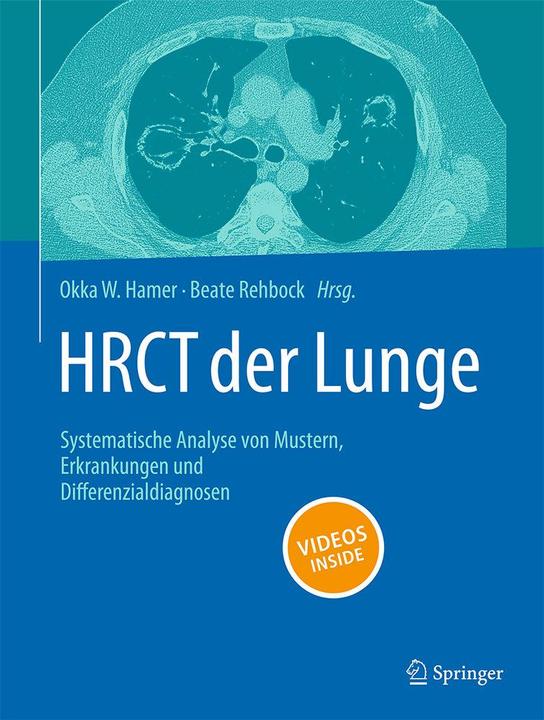 HRCT der Lunge - Interdiscount